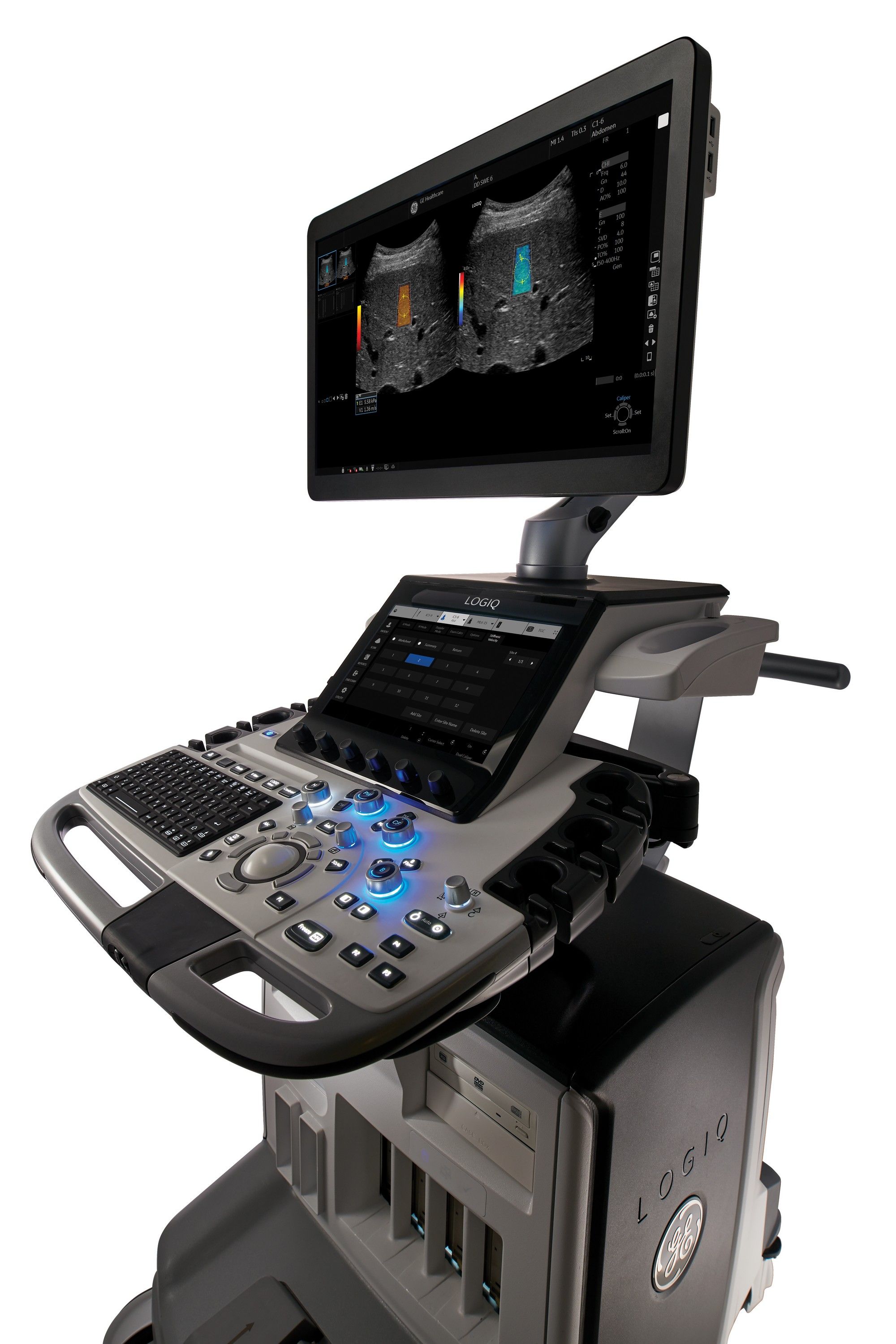 LOGIQ E10 - Ecografia › LOGIQ - Medisol. Soluzioni per la cardiologia, sistemi ecografici e ...