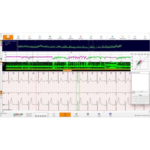 DMS CardioScan - Cardiologia › Cardiologia diagnostica › Sistemi Holter ...
