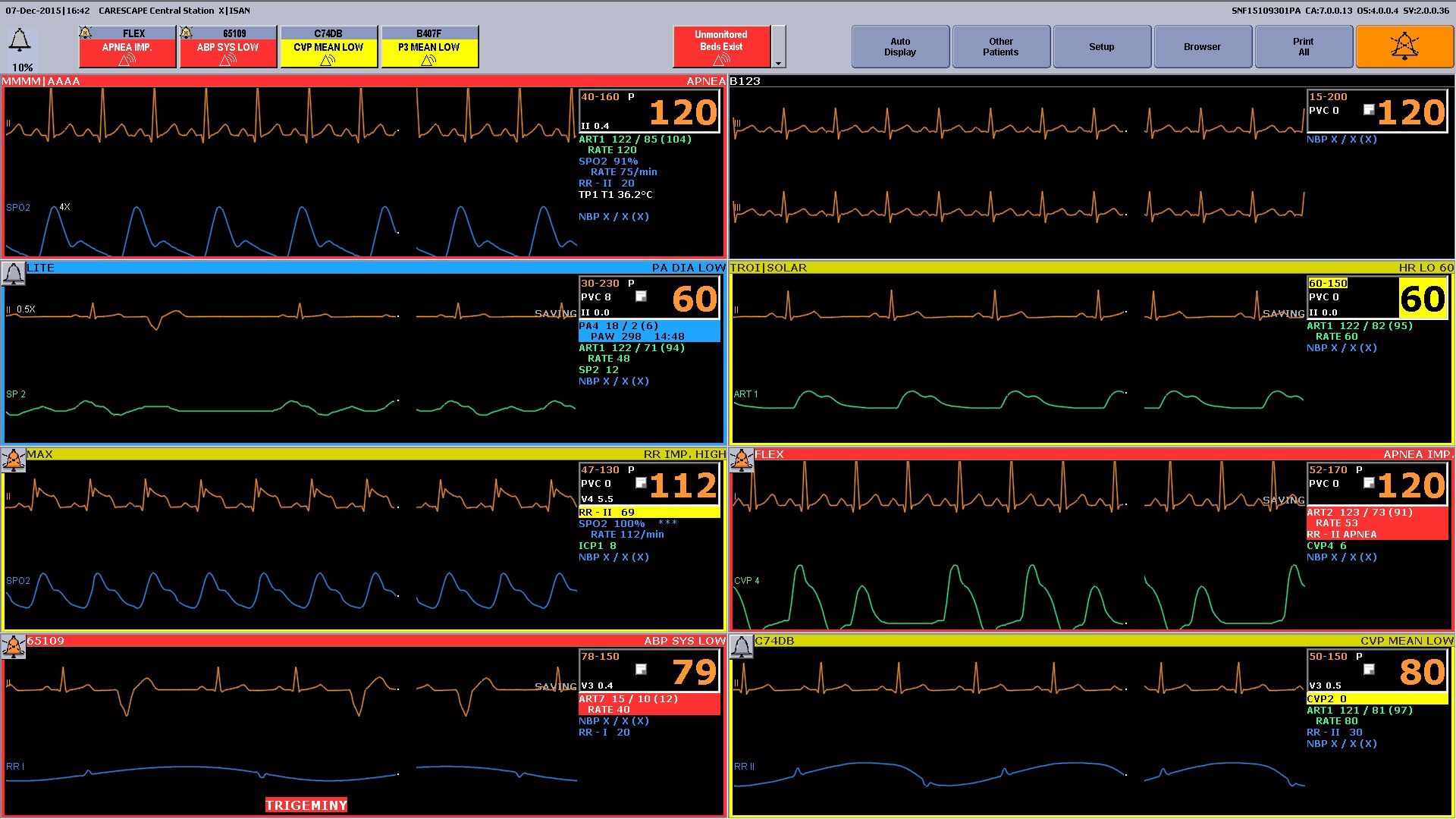 Centrale monitoraggio Carescape CSCS - Cardiologia › Cardiologia ...