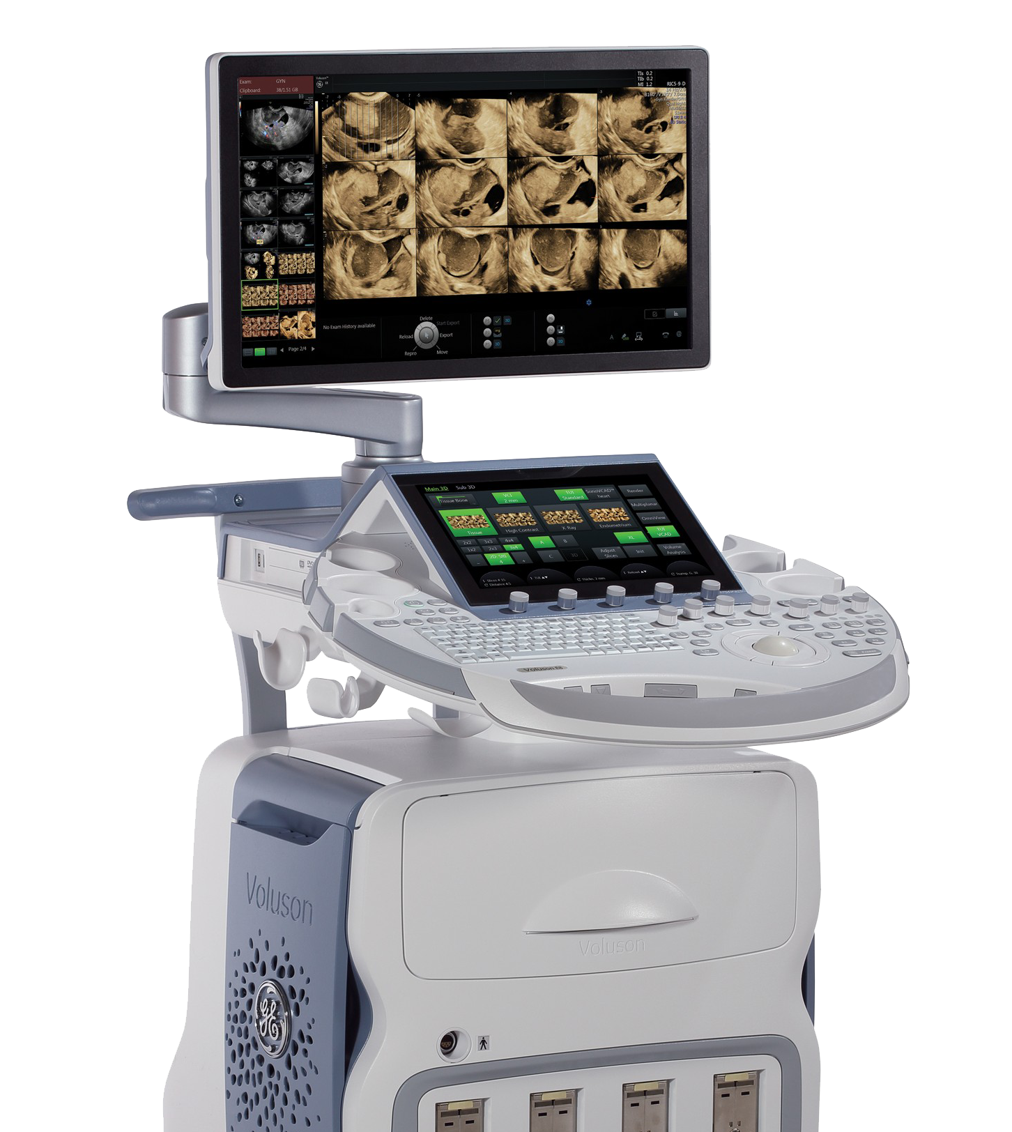 Voluson E8 - Ecografia › VOLUSON - Medisol. Soluzioni per la ...