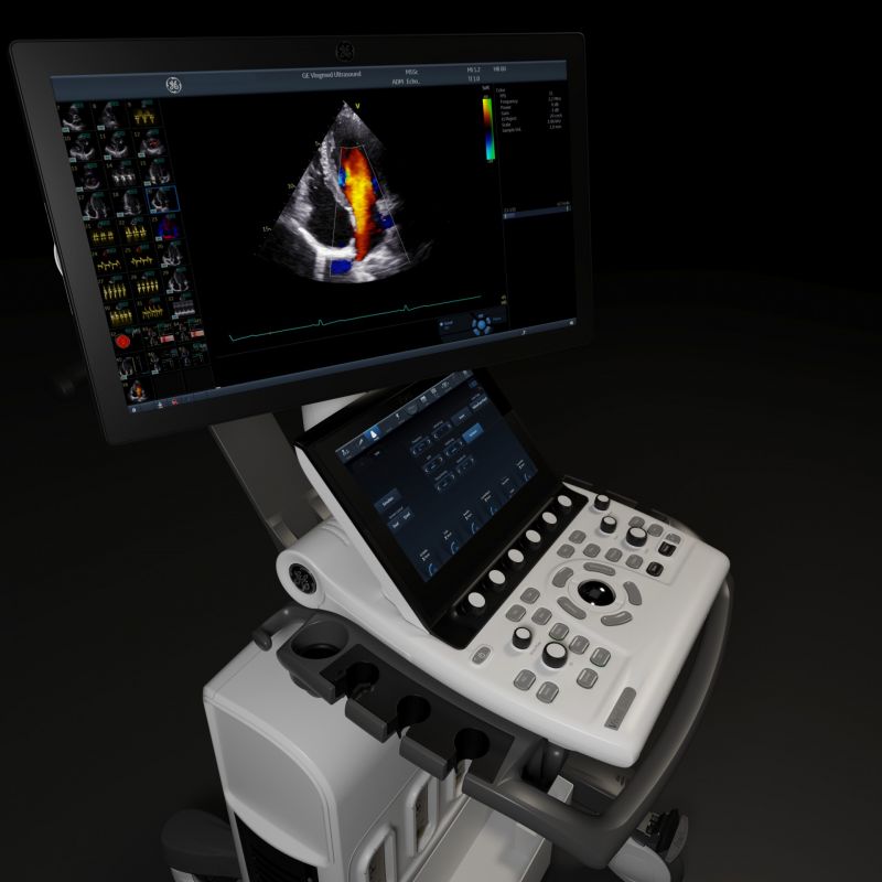 Vivid S70N Ultra Edition - Ecografia › VIVID - Medisol. Soluzioni per ...