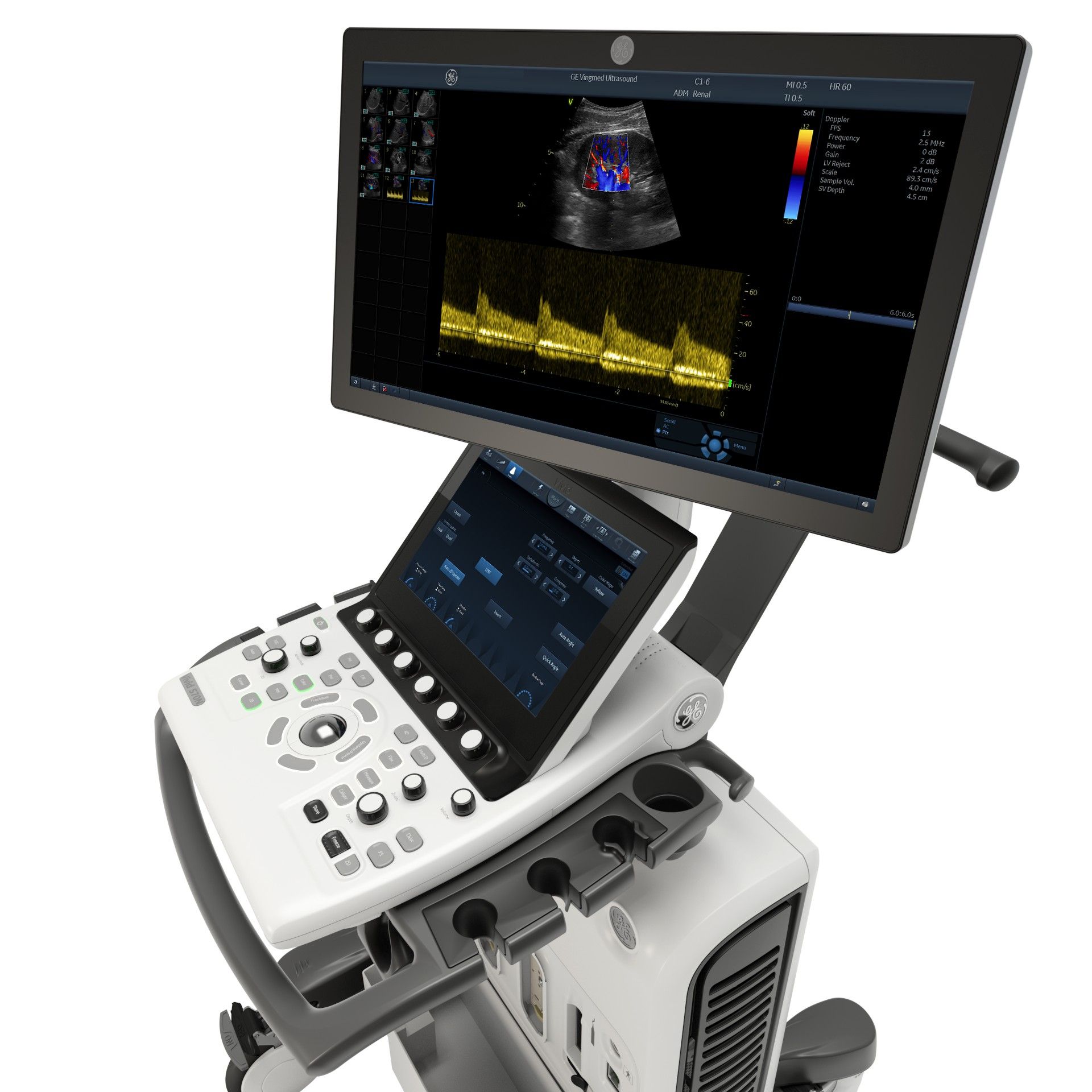 Vivid S70N Ultra Edition - Ecografia › VIVID - Medisol. Soluzioni per ...