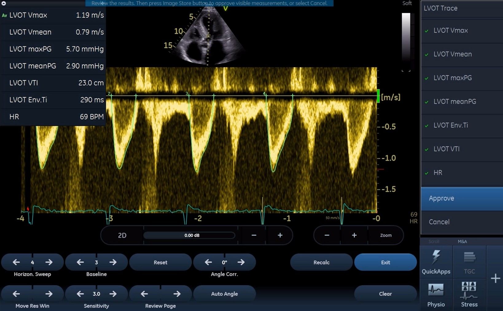 Vivid iq Ultra Edition - Ecografia › VIVID - Medisol. Soluzioni per la ...